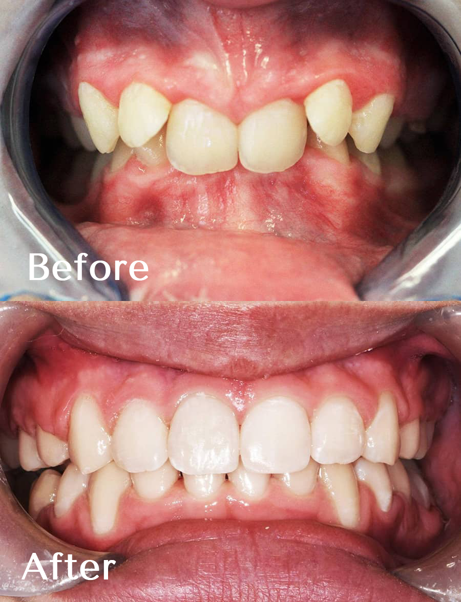 Smile Gallery | Warrnambool Smile Dental